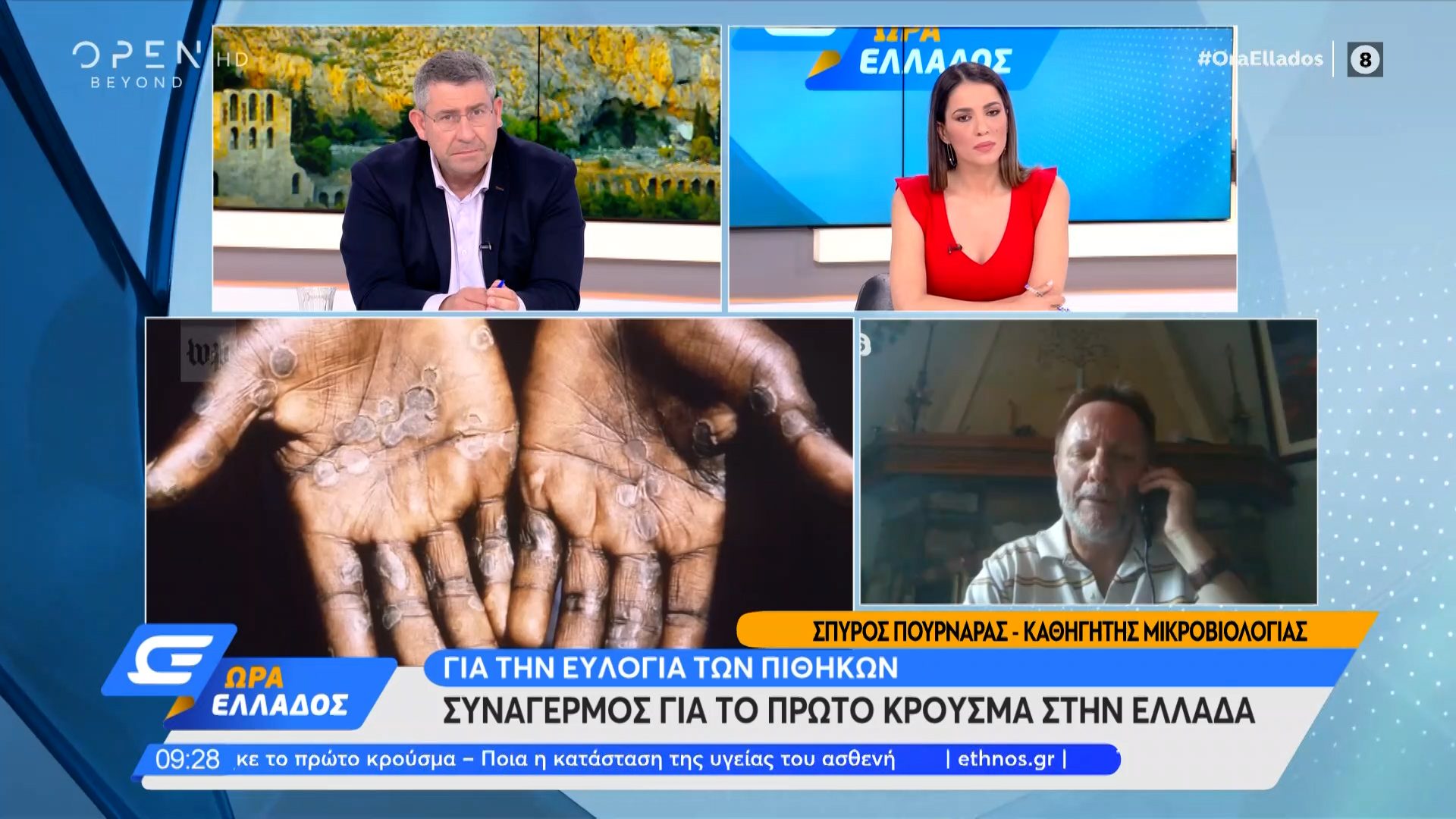 Ο Σπύρος Πουρνάρας για την ευλογιά των πιθήκων | OPEN TV