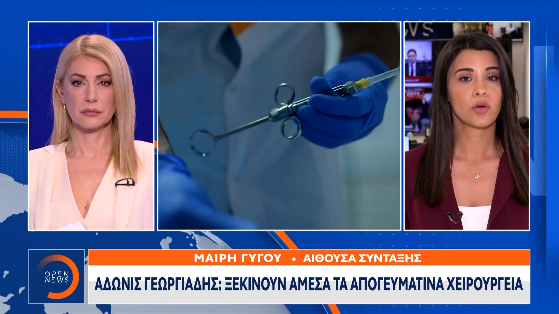Άδωνις Γεωργιάδης: Ξεκινούν άμεσα τα απογευματινά χειρουργεία | OPEN TV