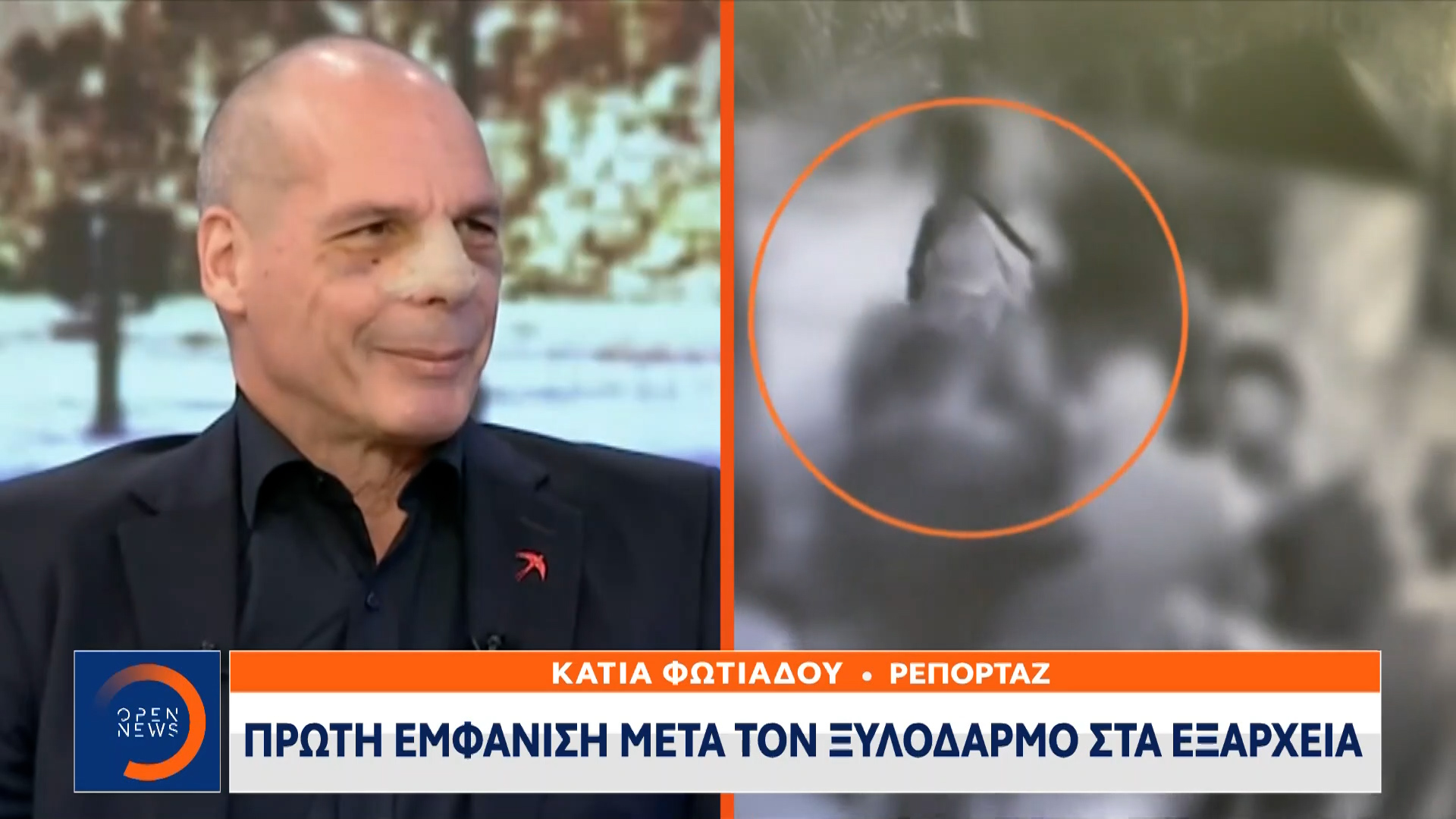 Γιάνης Βαρουφάκης: Πρώτη εμφάνιση μετά τον ξυλοδαρμό στα Εξάρχεια | OPEN TV