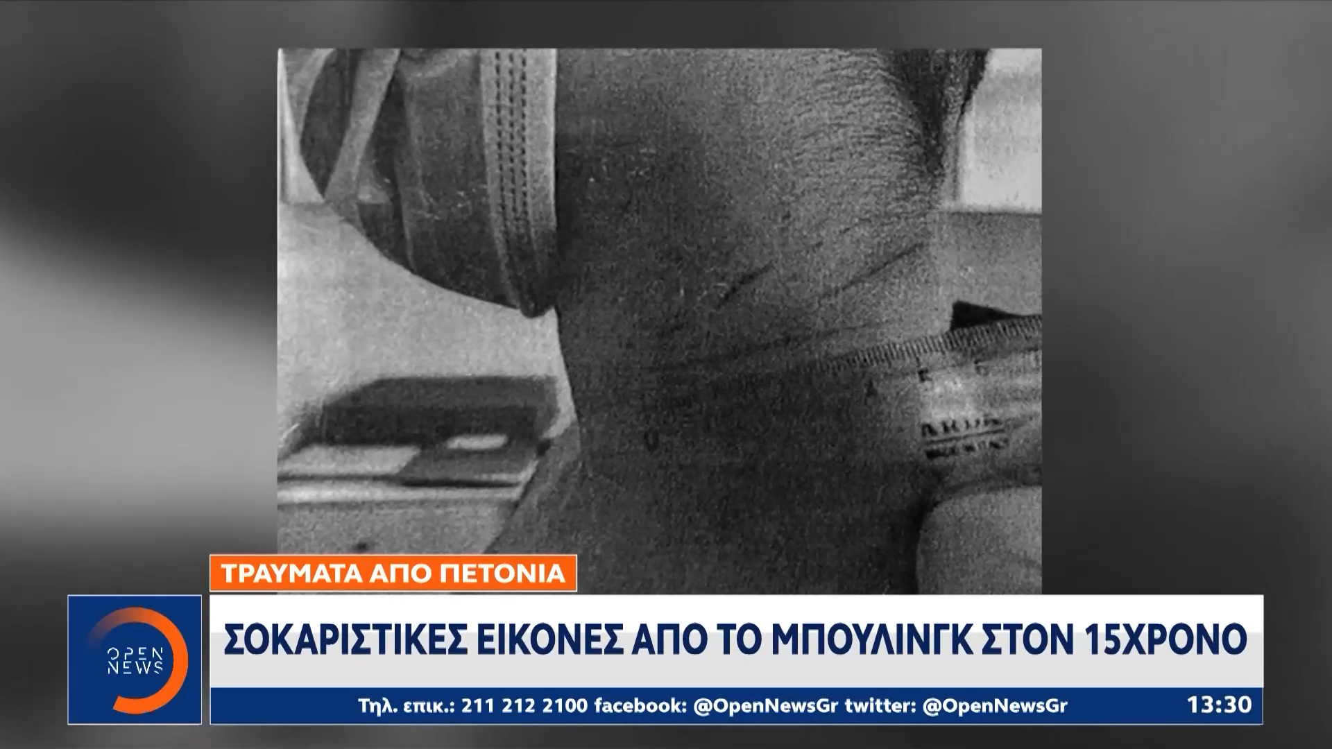 Σοκαριστικές εικόνες από το μπούλινγκ στον 15χρονο | OPEN TV
