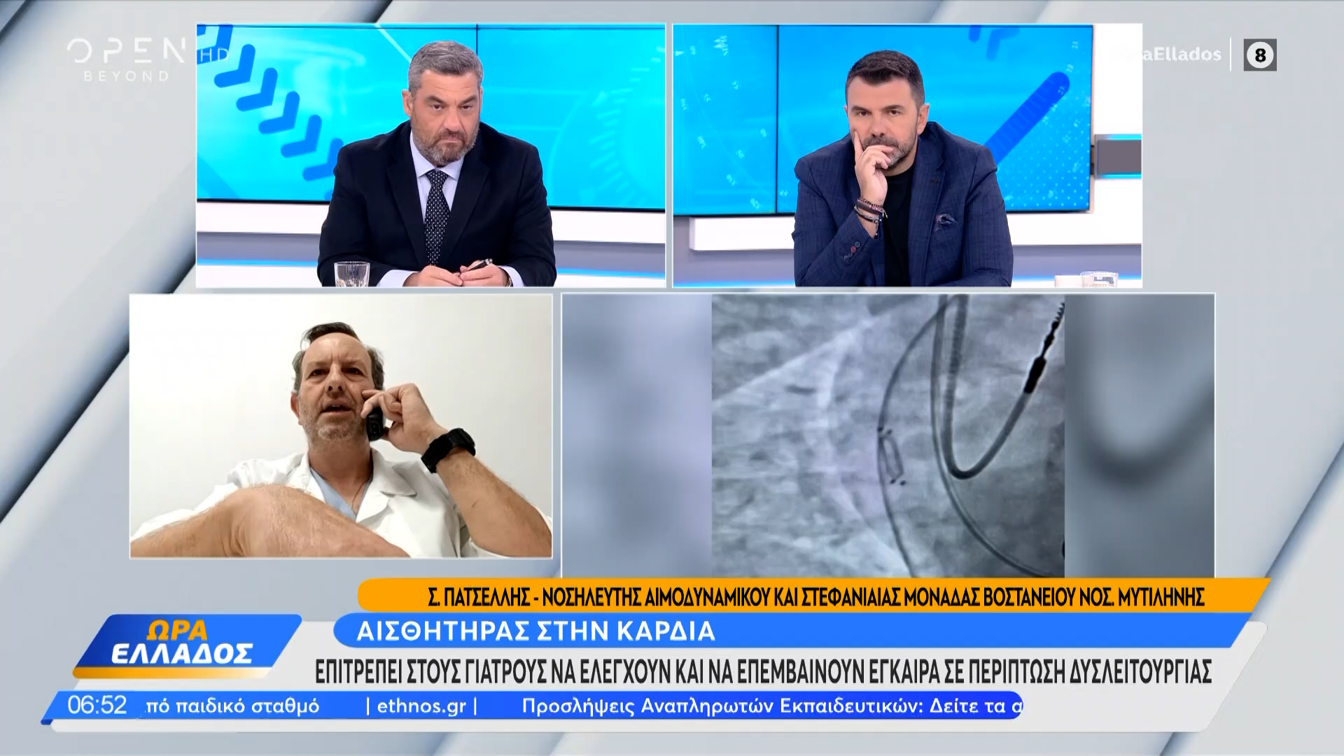 Πρωτοποριακή επέμβαση - Αισθητήρας στην καρδιά | OPEN TV
