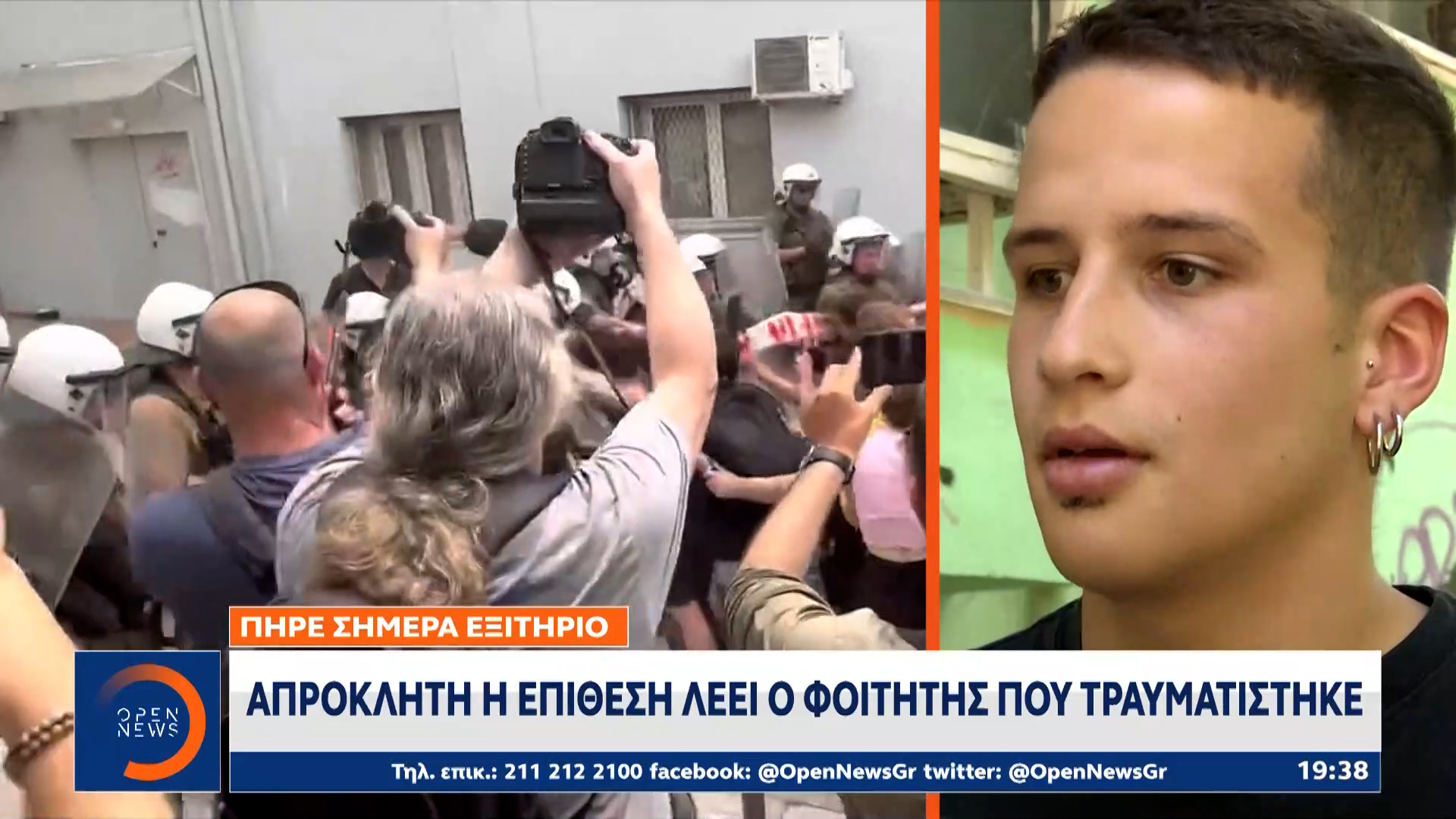 ΑΠΘ: Απρόκλητη η επίθεση λέει ο φοιτητής που τραυματίστηκε | OPEN TV