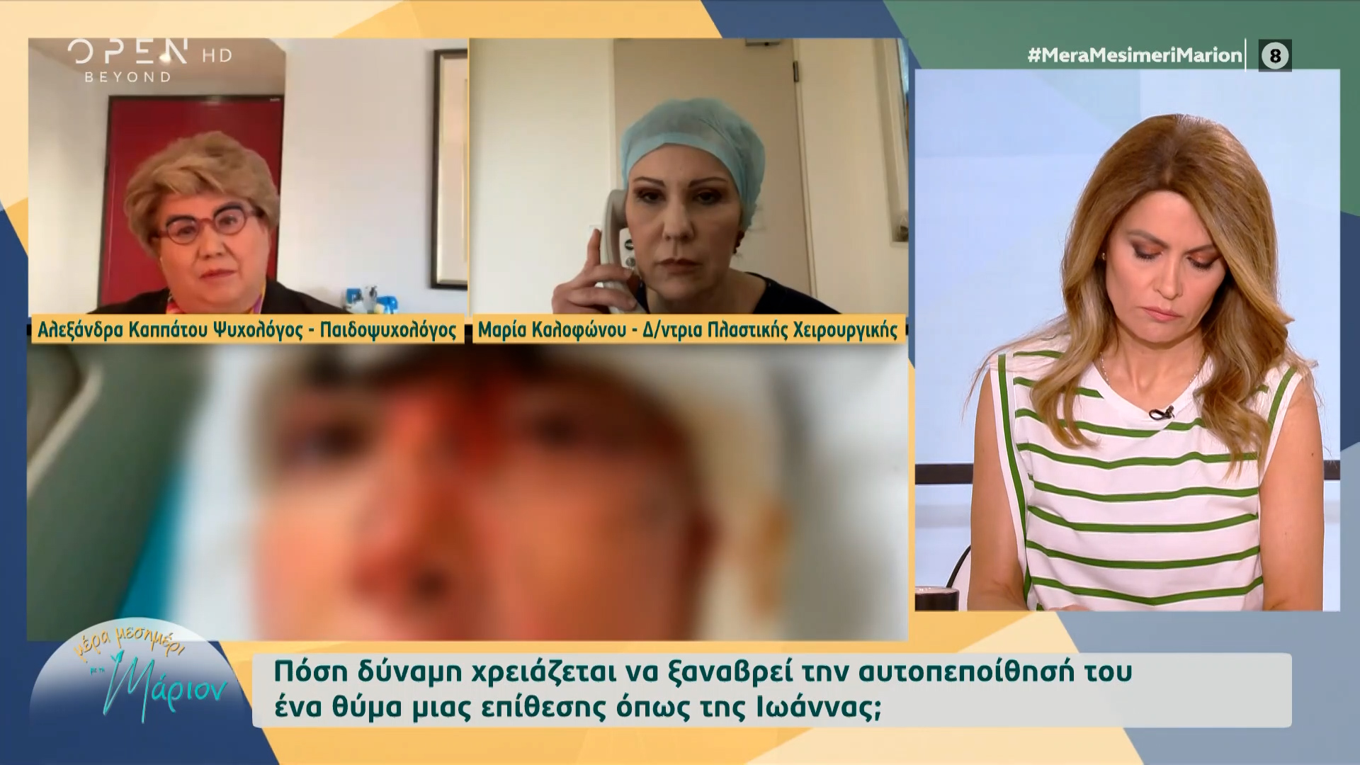 Ψυχολόγος: Η Ιωάννα Παλιοσπύρου δεν θέλει τον οίκτο και αυτό είναι ...