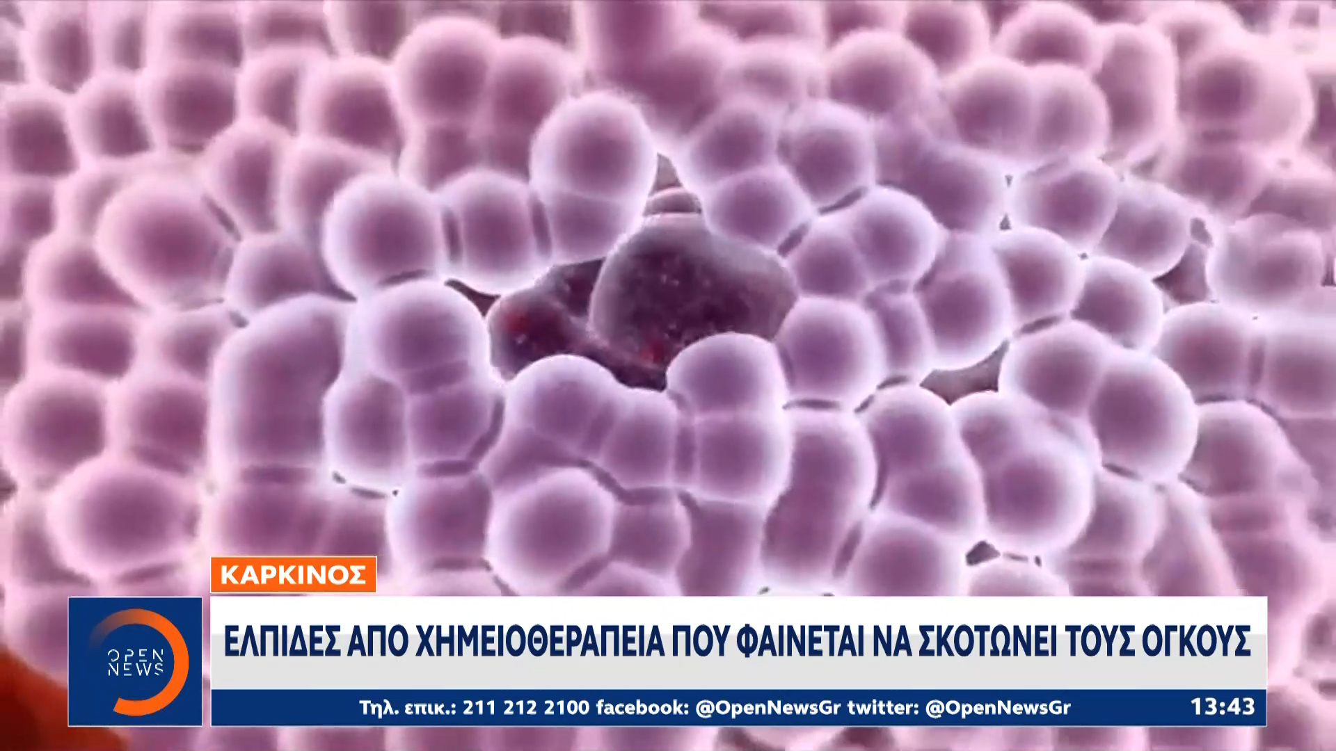 Καρκίνος: Ελπίδες από χημειοθεραπεία που φαίνεται να σκοτώνει τους ...